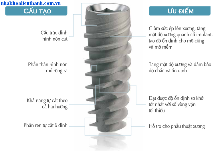 Implant JDent sản xuất tại Ý thêm lựa chọn nha khoa cao cấp. - Nha Khoa ...
