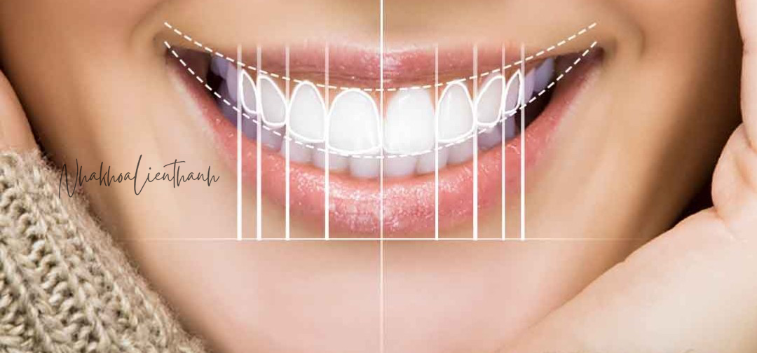 Tiêu chí đánh giá hàm răng đẹp - Nha Khoa Liên Thanh